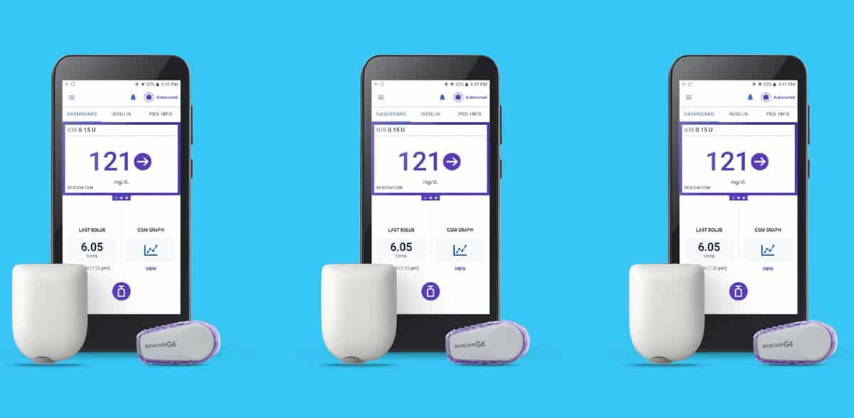 My Experience with Omnipod 5 – Sugar Medical